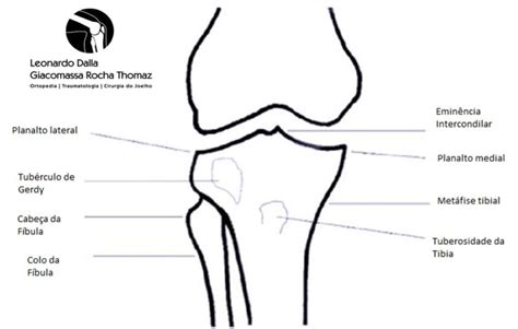 Eminencia Intercondílea Tibial