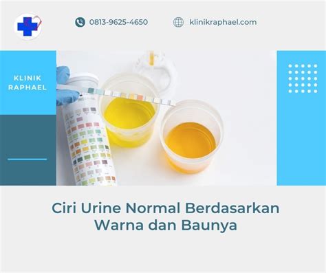 Ciri Urine Normal Berdasarkan Warna Dan Baunya