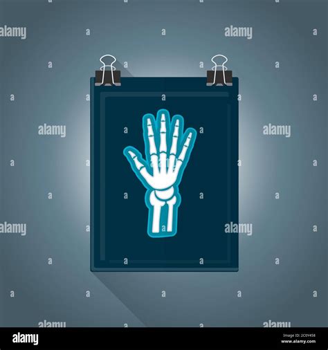 vector flat radiography illustration icon Stock Photo - Alamy
