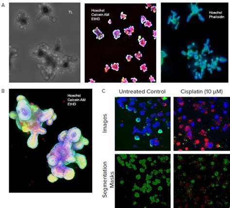 Enabling Complex Organoid Assays By Leveraging Automated Workflows