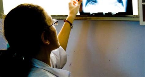 Ldct Screening And Lung Cancer