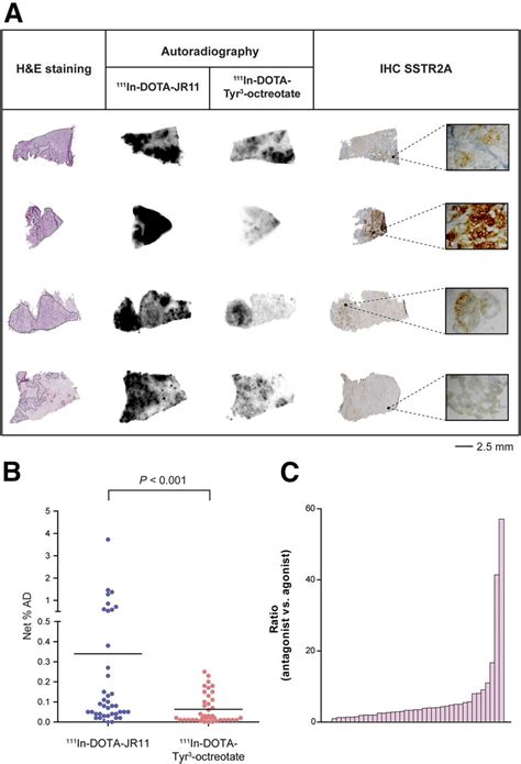 Sstr Mediated Imaging In Breast Cancer Is There A Role For