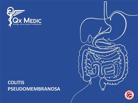 Ft GastroenterologÍa 3 Diarrea Crónica Colitis Pseudomembranosapdf