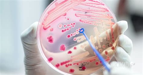One In Five Deaths Globally Are Due To Sepsis Much Higher Than