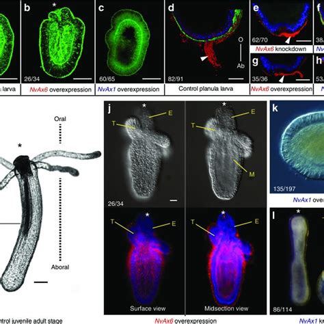 Model Of Hox Gene Function In Early Development Of An Anthozoan A
