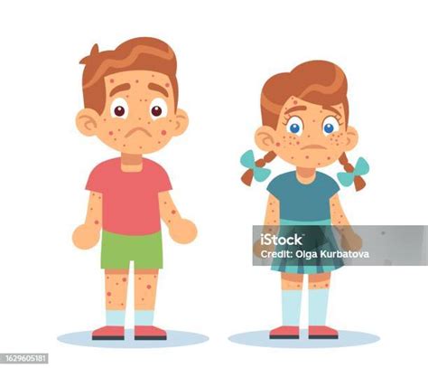 몸 전체에 발진이 있는 피부 문제가 있는 소년과 소녀 수두 홍역 및 아토피 성 피부염 피부과 치료 만화 평면 격리 그림입니다