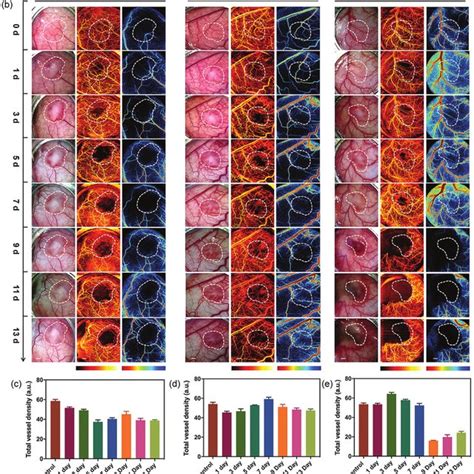 A Representative Photographs Of U87 Mg Tumor Bearing Mice In Various
