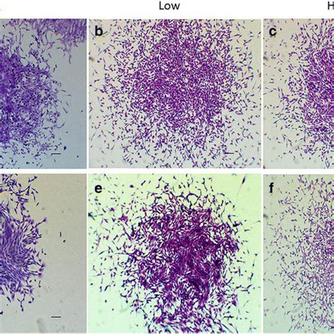 Colony Forming Assay A Representative Photograph Of A Freshly Isolated