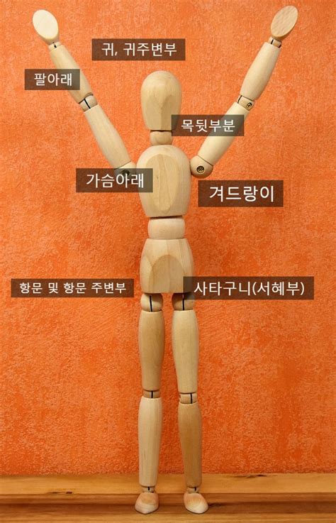 화농성 한선염 종기 여드름 피지낭종 맑은숲 엔 한의원 네이버 블로그