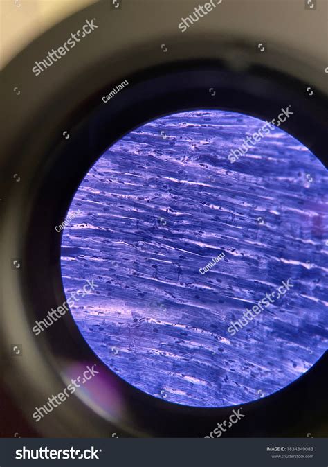 Cardiac Muscle Tissue Intercalated Discs