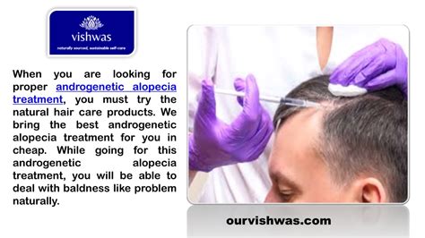 Ppt Androgenetic Alopecia Treatment Powerpoint Presentation Free