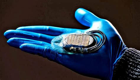 Pacemaker Membrane Could Simplify Replacement Surgeries Futurity