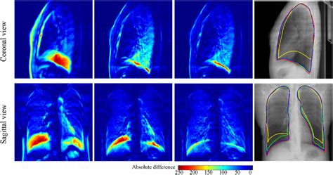 The Absolute Difference Images First Column The Difference Between Download Scientific