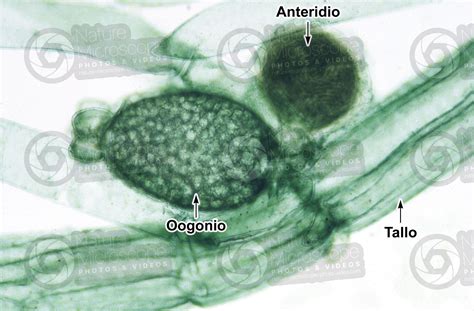 Chara Algae Microscope