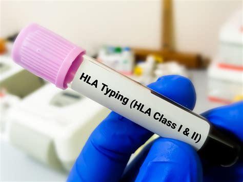 What Is The Hla Dnagenics Blog