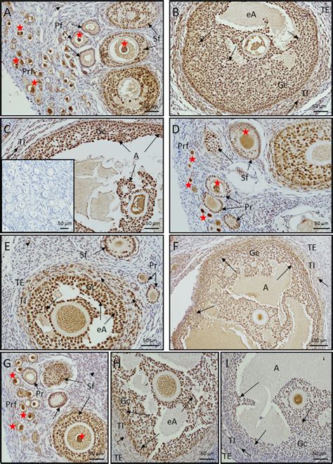 Immunohistochemical Localization Of Proliferating Cell Nuclear Antigen