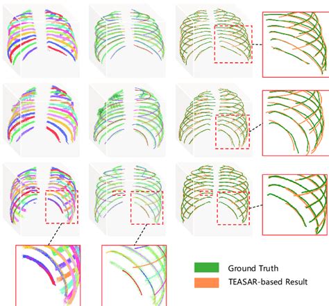 Visualization Of Centerline Extraction Results This Figure Includes