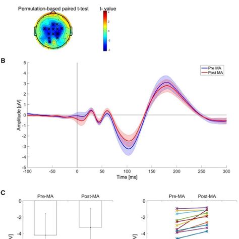 A Tms Evoked Potentials Tep N100 Time Locked To Tms Pulse Pre And Download Scientific