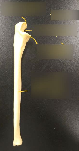 Ulna Ulna Side Angle Bone Model Skin Model Tissue Lab Slides