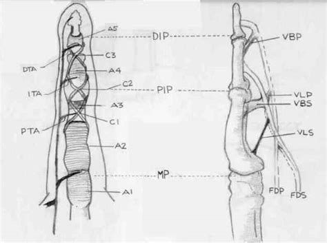 Trigger Finger Tenosynovitis Wheeless Textbook Of Orthopaedics