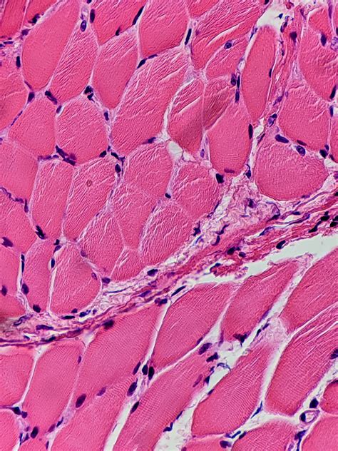 Skeletal Muscle Description With Cross Section Struct