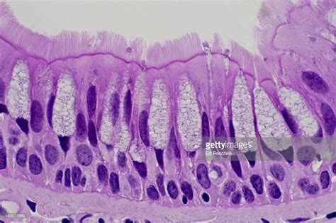 Pseudostratified Ciliated Columnar Epithelium Diagram Quizlet
