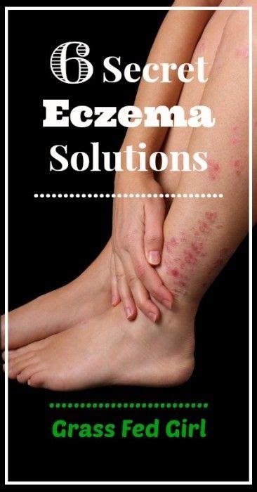 Skin Allergic Reaction To Grass Uces