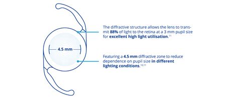 Acrysof Iq Panoptix Trifocal Iol Lens Option For Cataract Patients