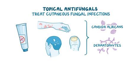 Video Antifungals Topical Nursing Pharmacology Osmosis