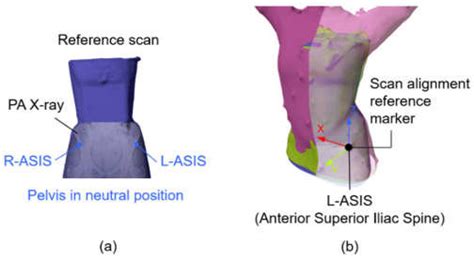 Alignment Of The Different Scans Obtained During The Patient Assessment