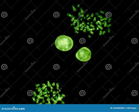 Chromosomes Under Fluorescence Microscope Green Colored Human