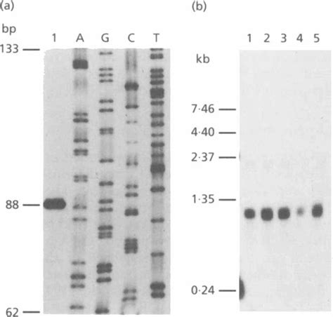 Analysis Of The Transcription Of Idhl A Primer Extension Experiment