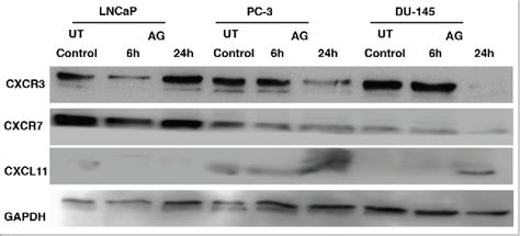Andrographolide Inhibits Prostate Cancer By Targeting Cell Cycle
