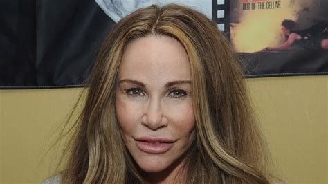 Dr Lynn Fynn On Gettr 💉 20211020tawny Kitaen Cause Of Death Heart