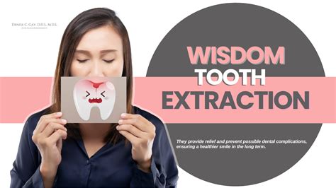 Wisdom Tooth Extraction In Naples Fl
