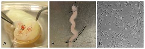 A Representative Picture Of A Human Umbilical Cord Showing The