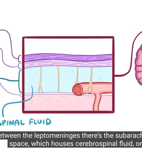 Meningitis Flashcards Quizlet
