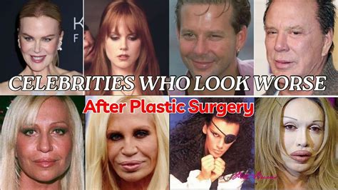 Celebrity Plastic Surgery Fails Revealed Uln Bro Medium