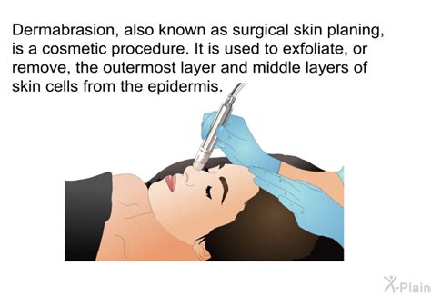 Dermabrasion