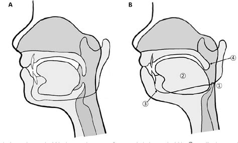 Figure 1 From Preoperative Risk Evaluation And Perioperative Management