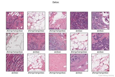 深度学习100例 —— 卷积神经网络cnn：乳腺癌识别cnn卷积神经网络 病理图像识别 Csdn博客