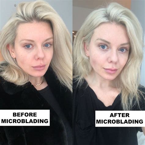 Microblading At Evertrue Salon Nyc {before And After Photos}