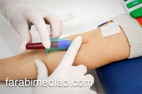 تفسیر آزمایش سلنیوم Selenium بهترین آزمایشگاه پاتوبیولوژی و تشخیص طبی⭐️