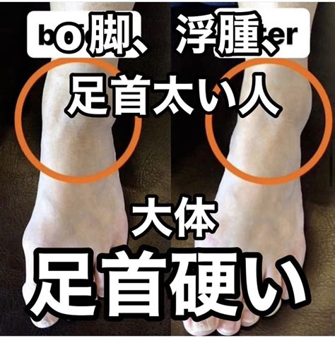 【o脚、浮腫、足首太い人、大体足首硬いです】 未病リハビリセンターハレル上通り店
