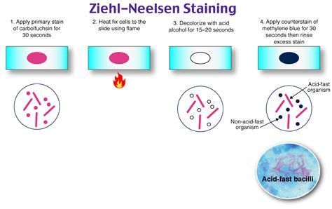 How To Crush The PA CAT Exam With Blueprint PA Practice Questions Blog Blueprint Prep