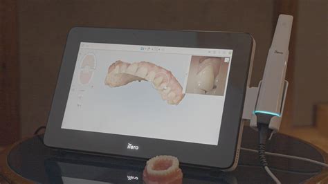 Lighting The Way Align Launches Itero Lumina Scanner Dentistry