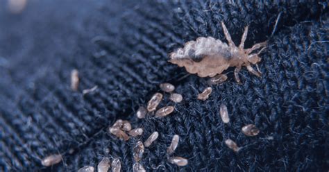 Lice VS Flea Comparison Friendly Guide To Pest Differences
