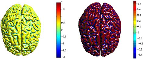 Characterization Of A Human Brain Cortical Surface Mesh Using Discrete Curvature Classification