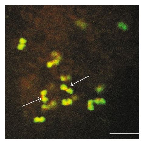 Colocalization Of Actin Labeled By Antibody Against Fragment Of