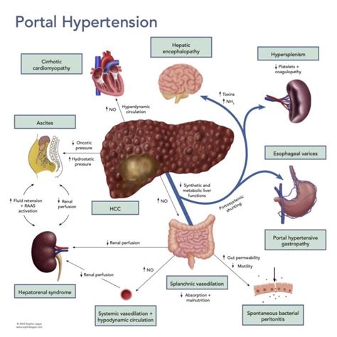Chronic Liver Disease And Cirrhosis Openanesthesia
